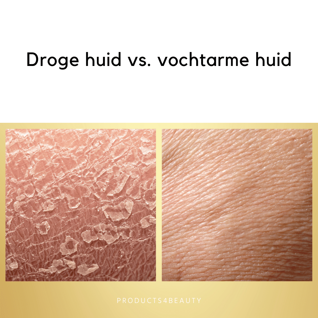 Verschil tussen een droge en vochtarme huid - Products4beauty Lage Zwaluwe